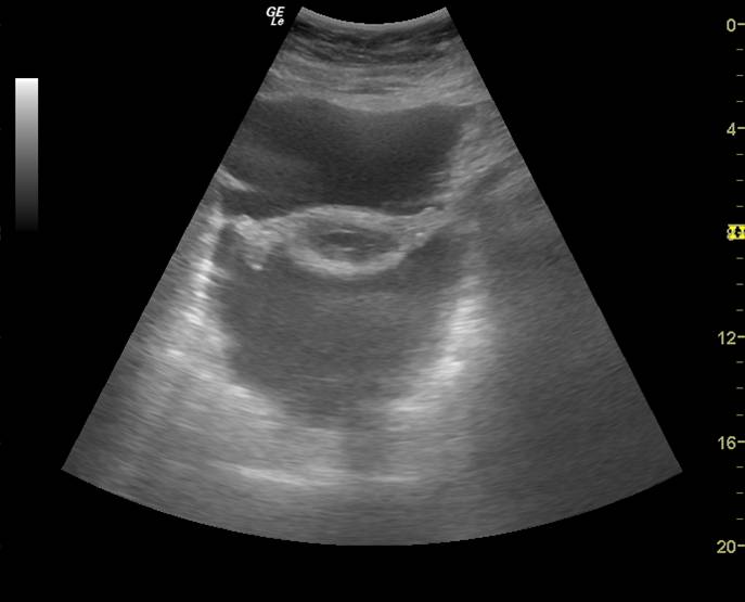 022_fast_012_001 - Ecografía Clínica - FESEMI