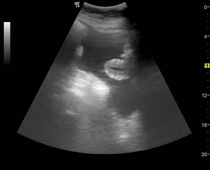 022_fast_012_002 - Ecografía Clínica - FESEMI