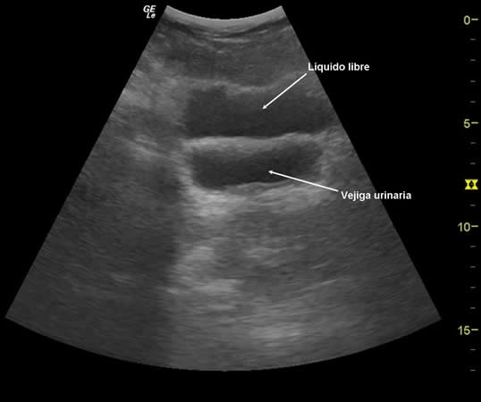 022_fast_013_001 - Ecografía Clínica - FESEMI